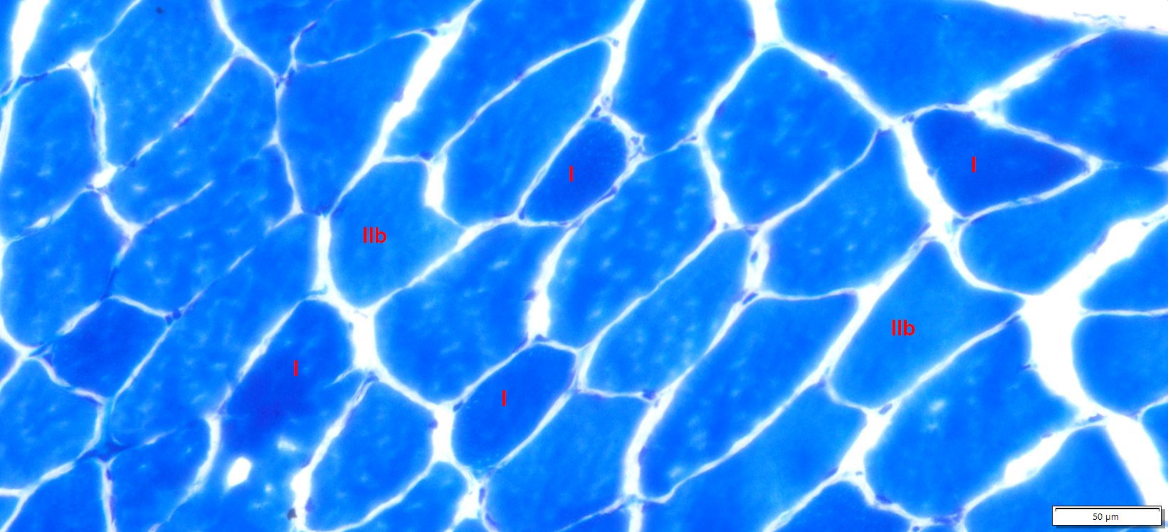 VitroView™ Metachromatic Myofibrillar ATPase Stain Kit