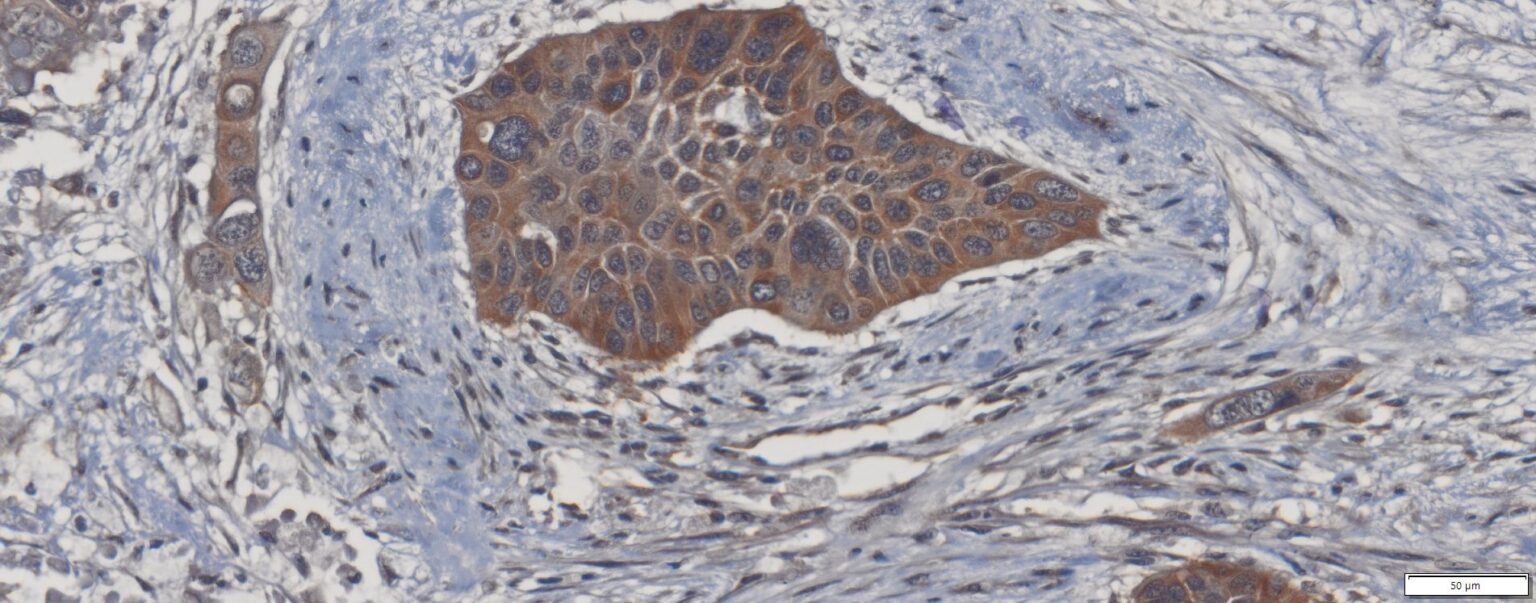 VitroView™ Universal 1-step Polymer-Based IHC/DAB kit (Anti-Mouse ...