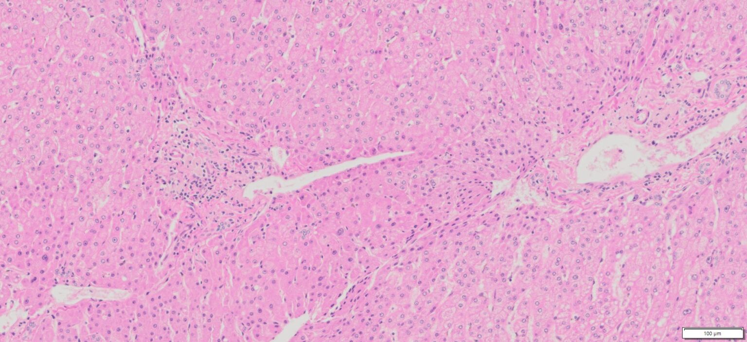 Human Liver Tissue (Non-cancer) FFPE Sections