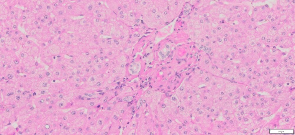 Human Liver Tissue (Non-cancer) FFPE Sections