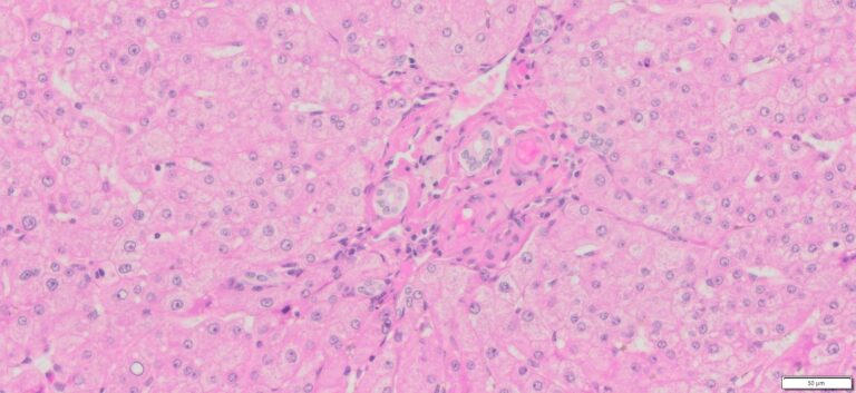 Human Liver Tissue (Non-cancer) FFPE Sections