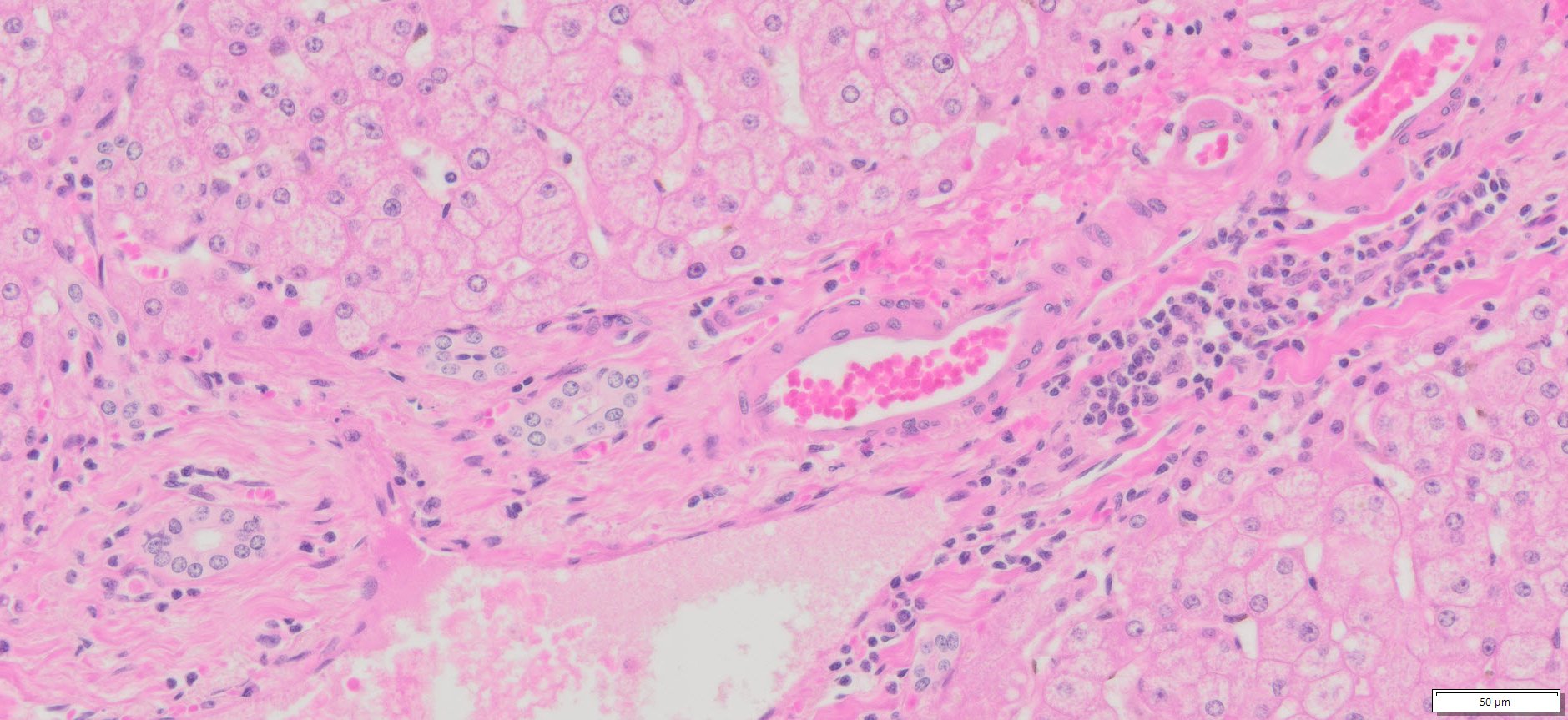 Human Liver Tissue (Non-cancer) FFPE Sections