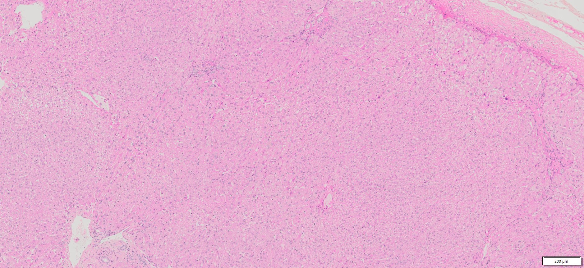 Human Liver Tissue (Non-cancer) FFPE Sections