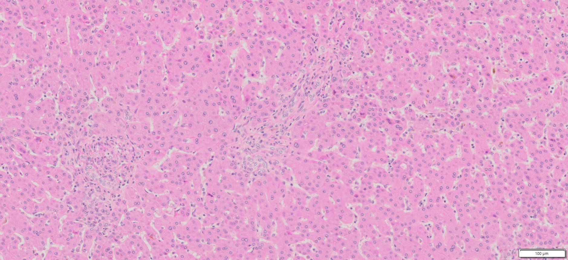 Human Liver Tissue (Non-cancer) FFPE Sections