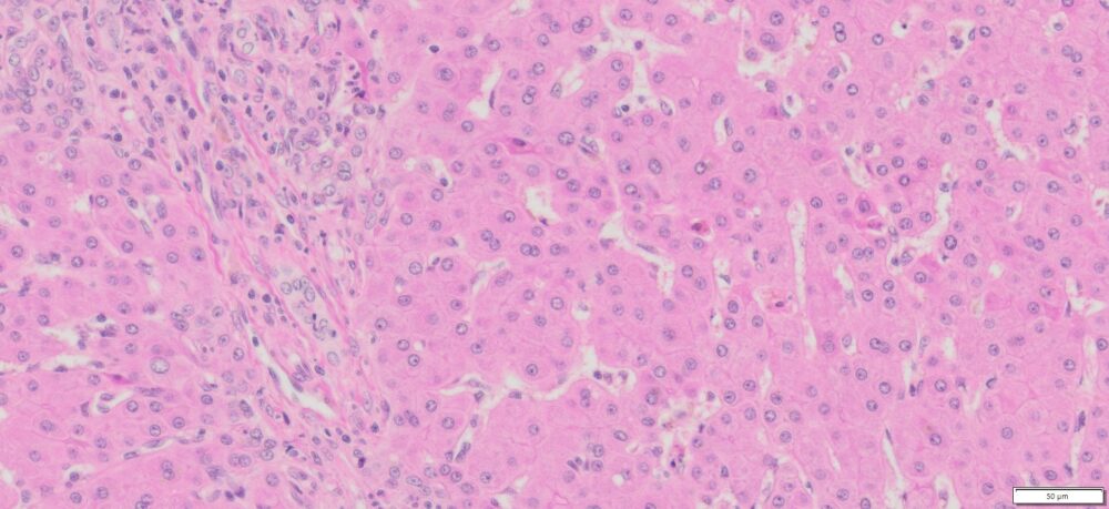 Human Liver Tissue (Non-cancer) FFPE Sections