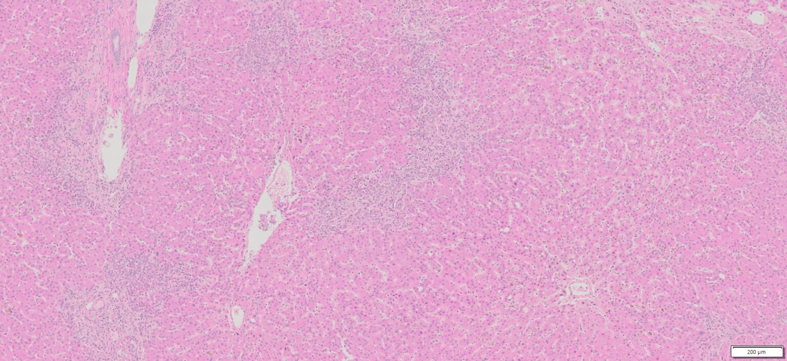 Human Liver Tissue (Non-cancer) FFPE Sections