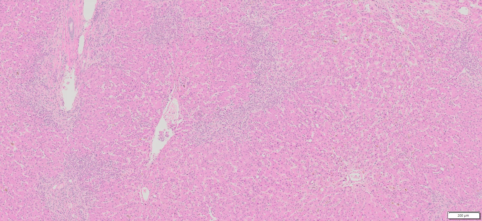 Human Liver Tissue (Non-cancer) FFPE Sections
