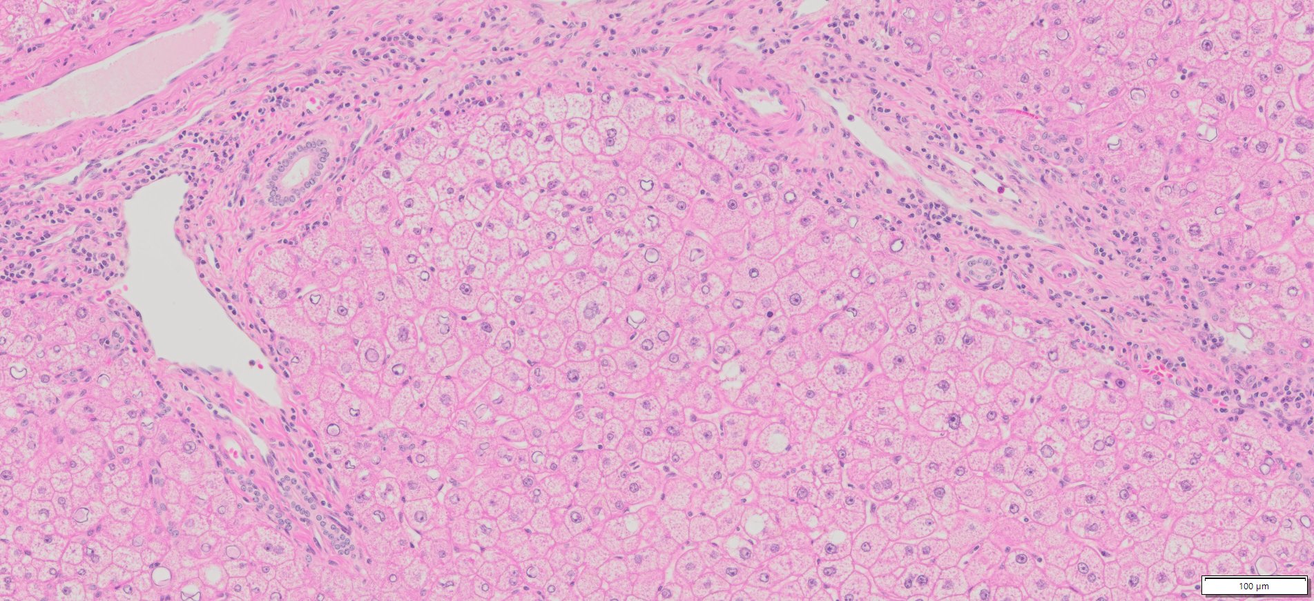 Human Liver Tissue (Non-cancer) FFPE Sections