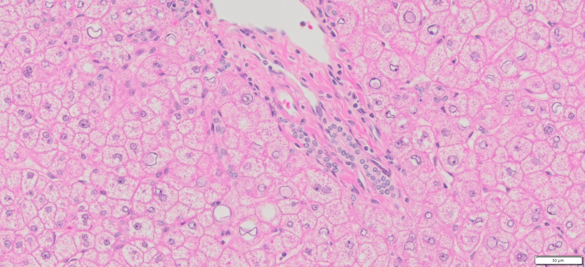 Human Liver Tissue (Non-cancer) FFPE Sections