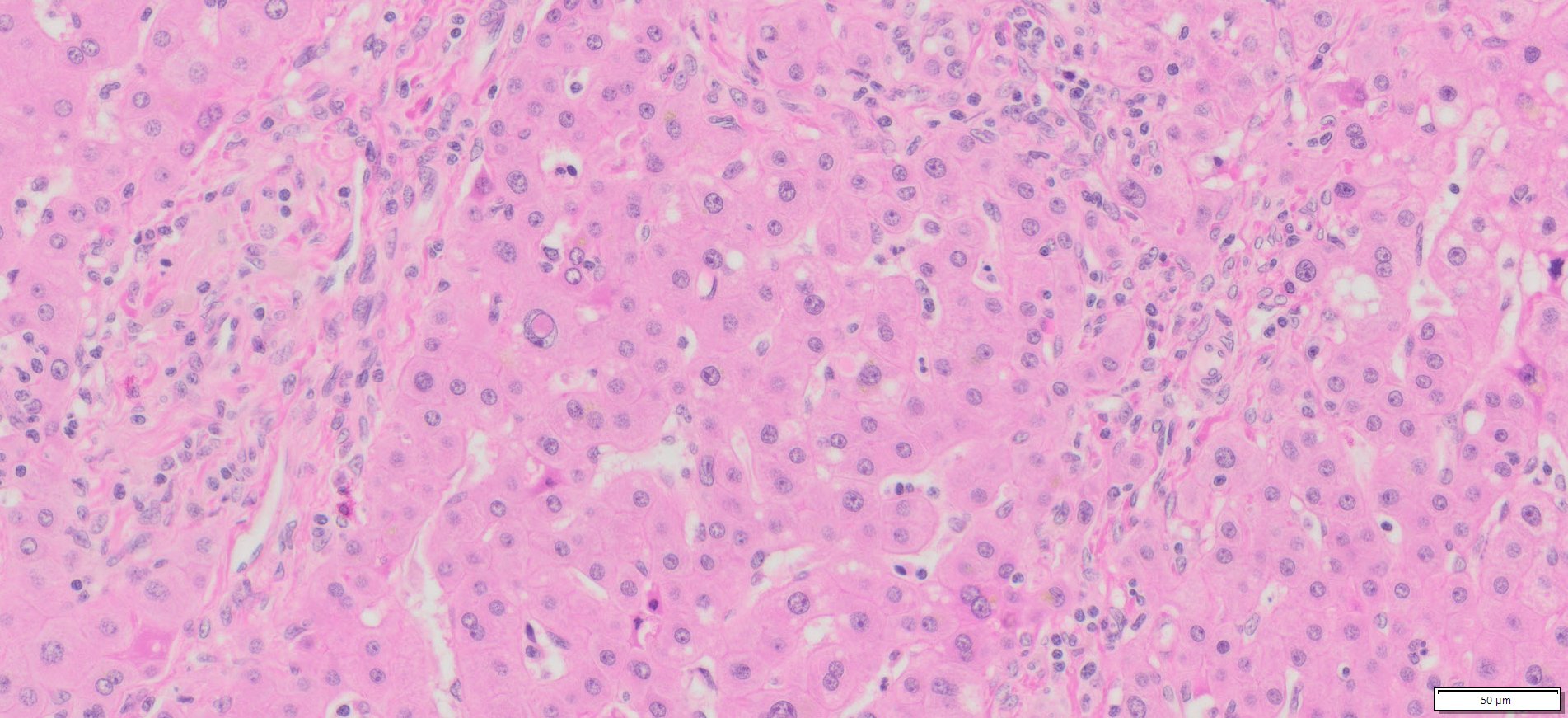 Human Liver Tissue (Non-cancer) FFPE Sections