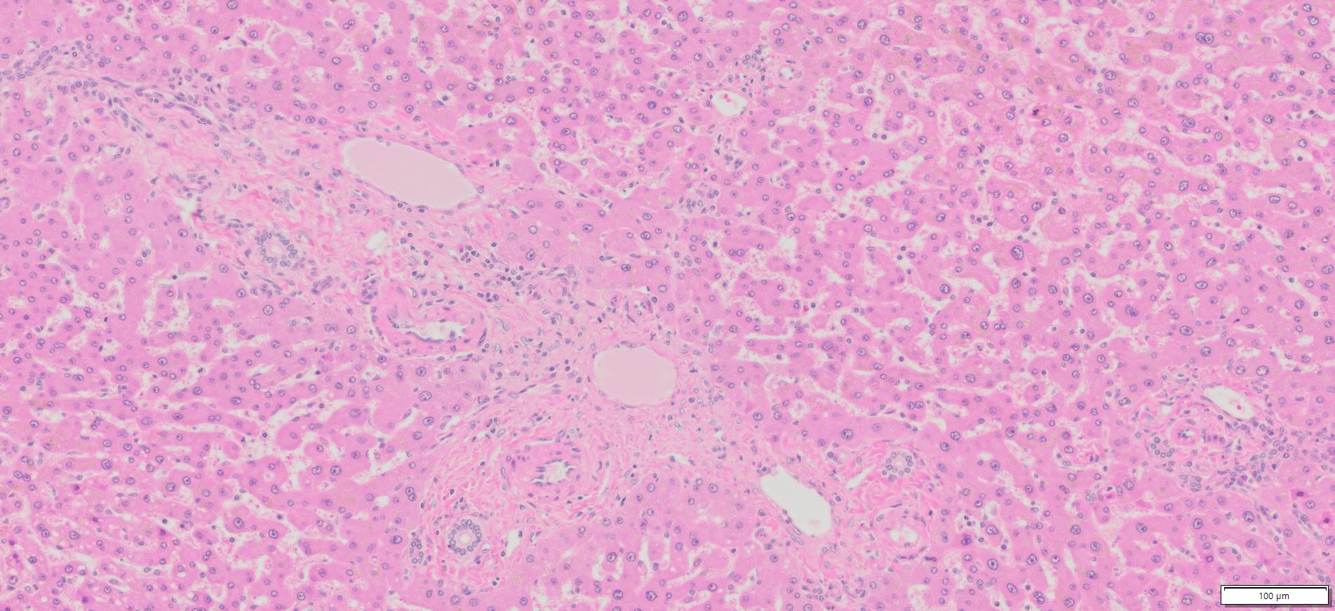 Human Liver Tissue (Non-cancer) FFPE Sections