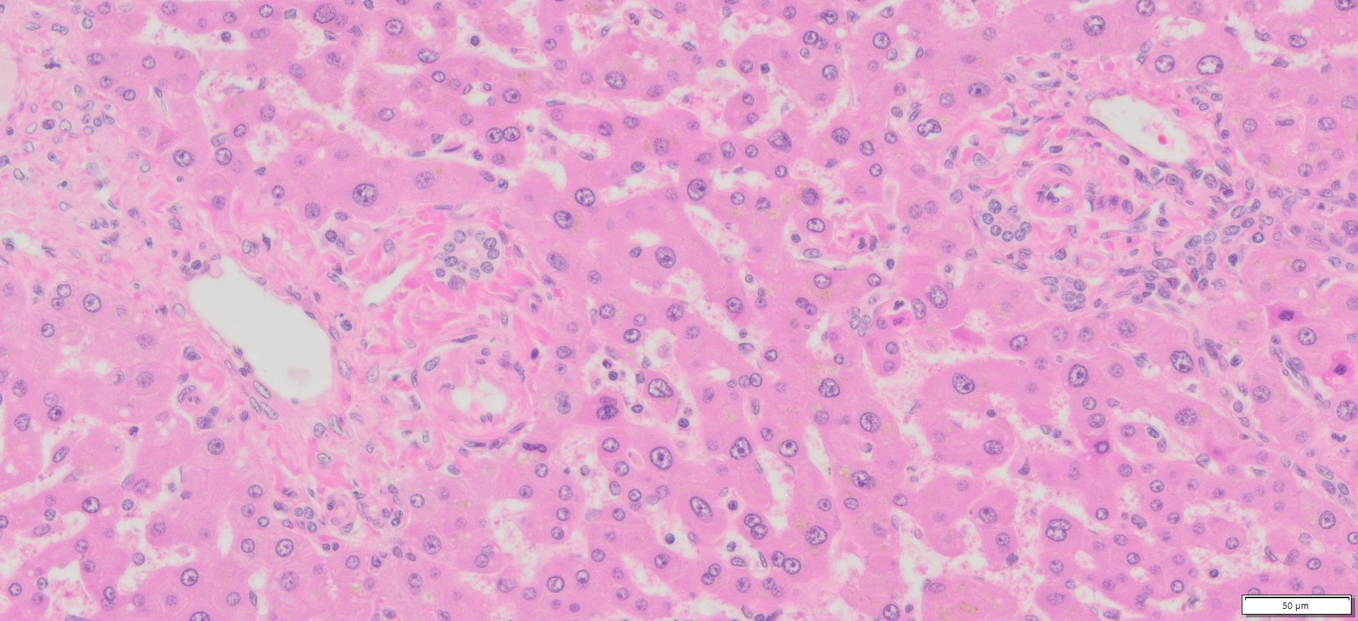 Human Liver Tissue (Non-cancer) FFPE Sections