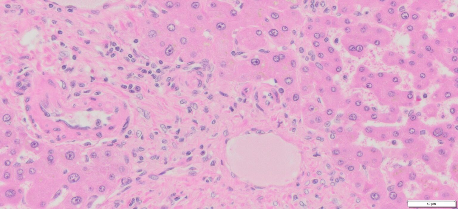 Human Liver Tissue (Non-cancer) FFPE Sections