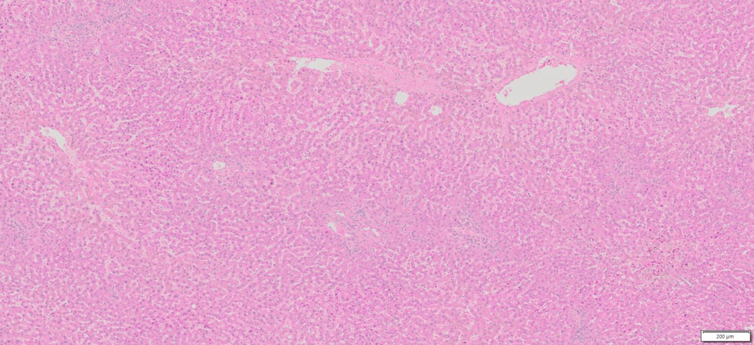 Human Liver Tissue (Non-cancer) FFPE Sections