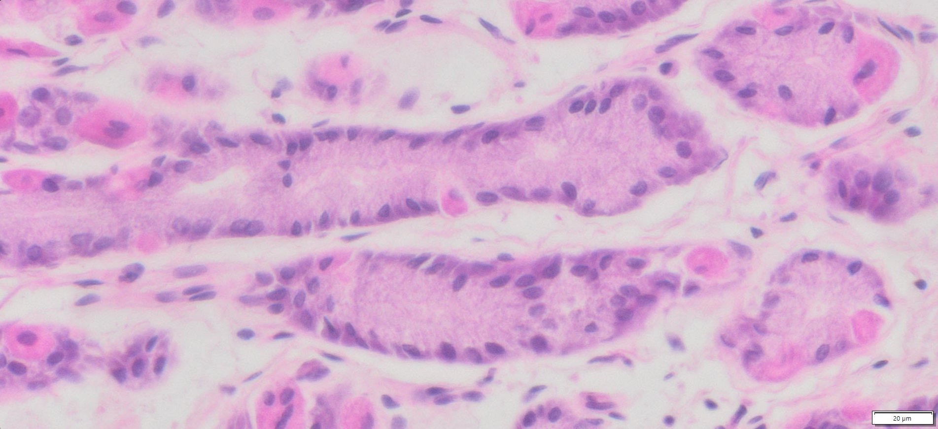 Human Stomach (Normal) FFPE Sections