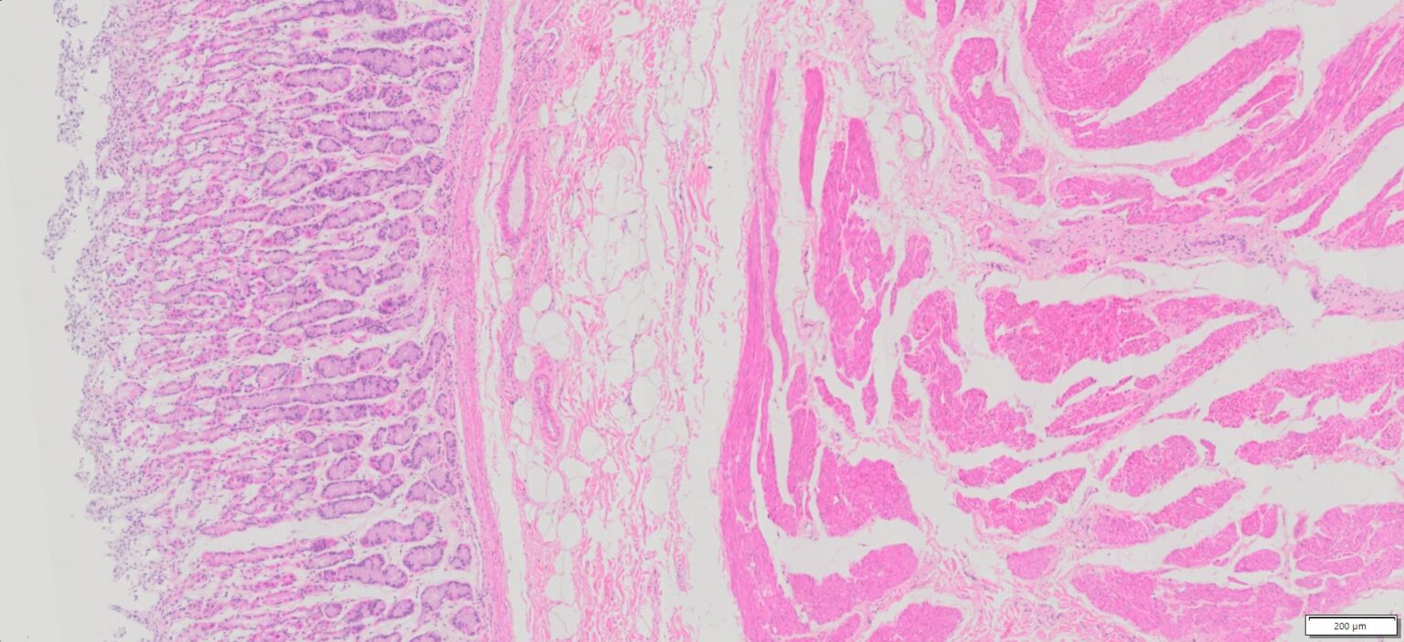 Human Stomach (Normal) FFPE Sections