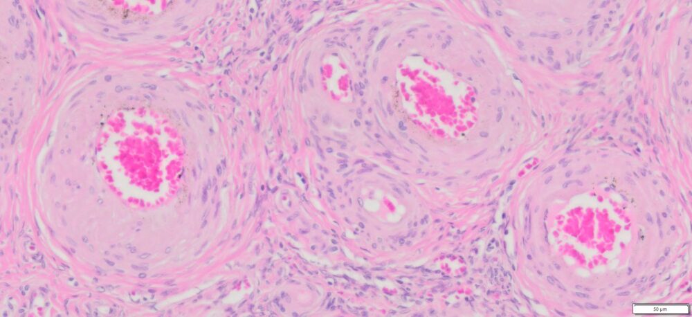 Human Ovary (Normal) FFPE Sections