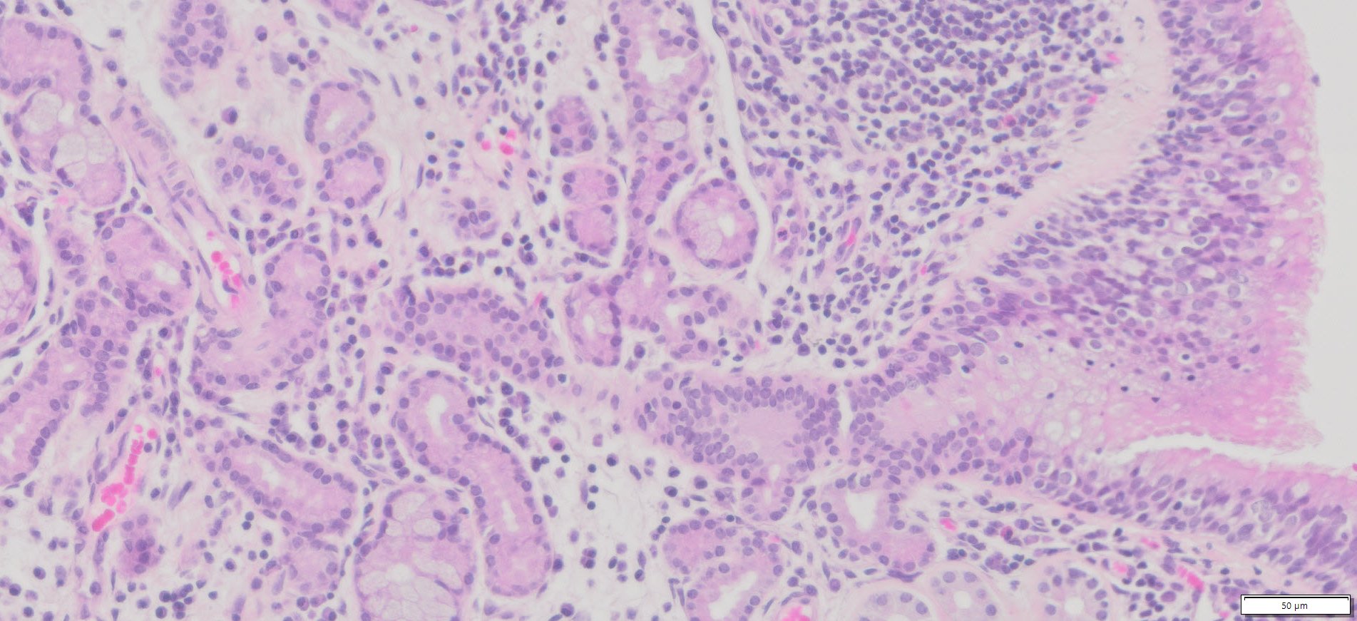 Human Sinus (Normal) FFPE Sections
