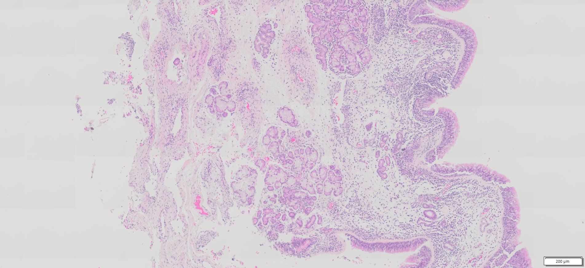 Human Sinus (Normal) FFPE Sections