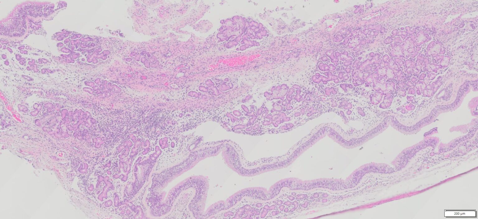 Human Sinus (Normal) FFPE Sections