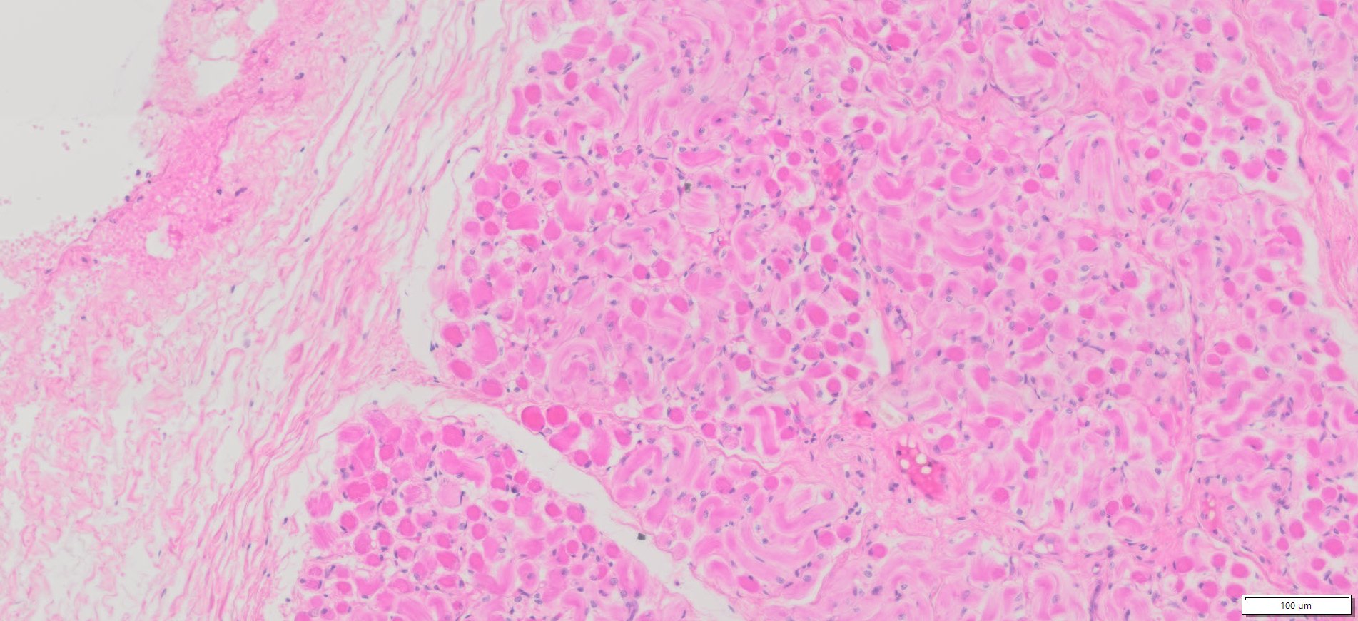 Human Tear Duct (Normal) FFPE Sections
