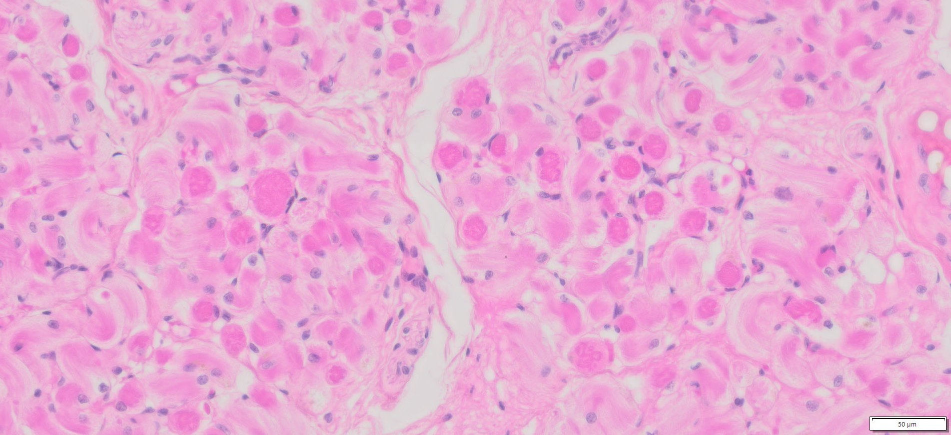 Human Tear Duct (Normal) FFPE Sections