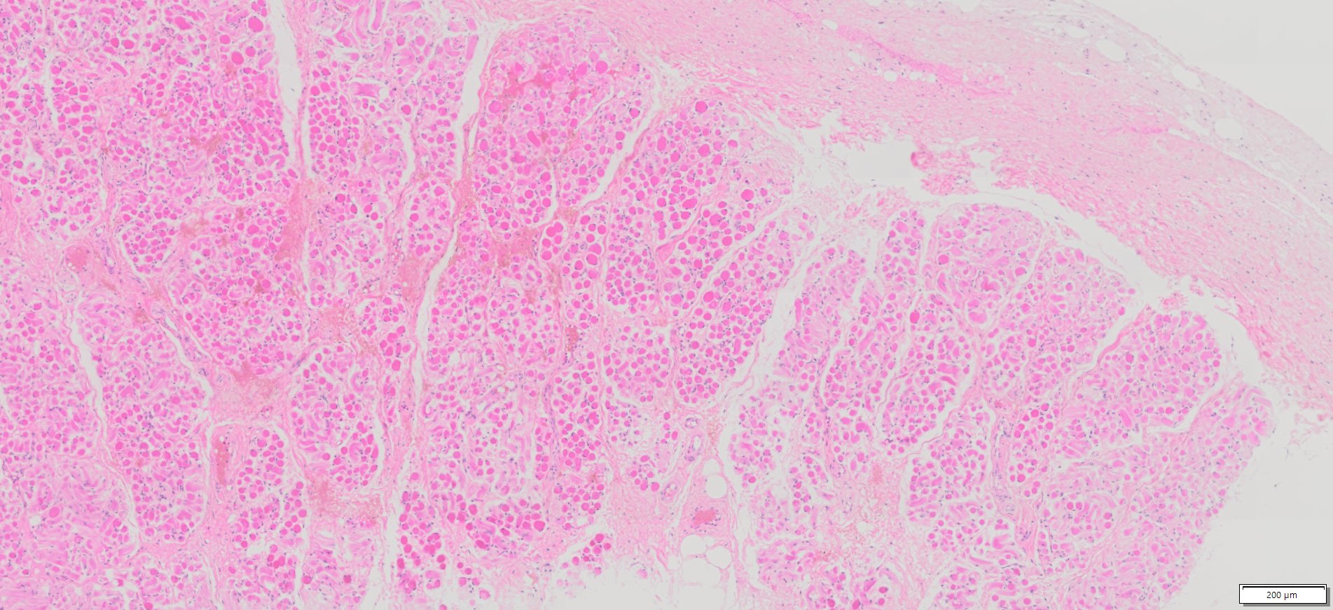 Human Tear Duct (Normal) FFPE Sections