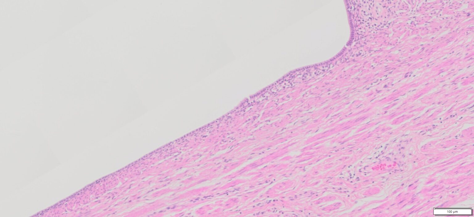 Human Cervical (Normal) Tissue FFPE Sections