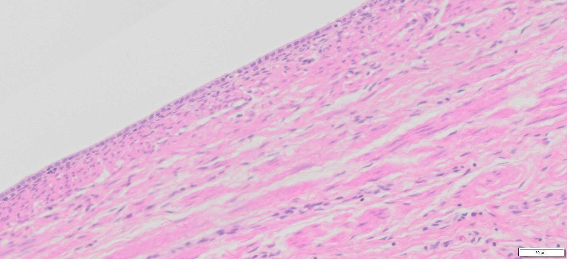 Human Cervical (Normal) Tissue FFPE Sections