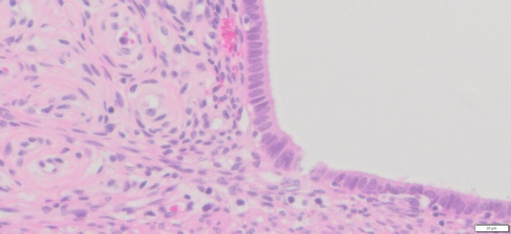 Human Cervical (Normal) Tissue FFPE Sections