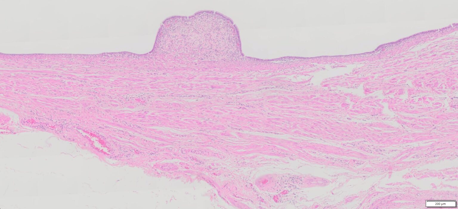 Human Cervical (Normal) Tissue FFPE Sections