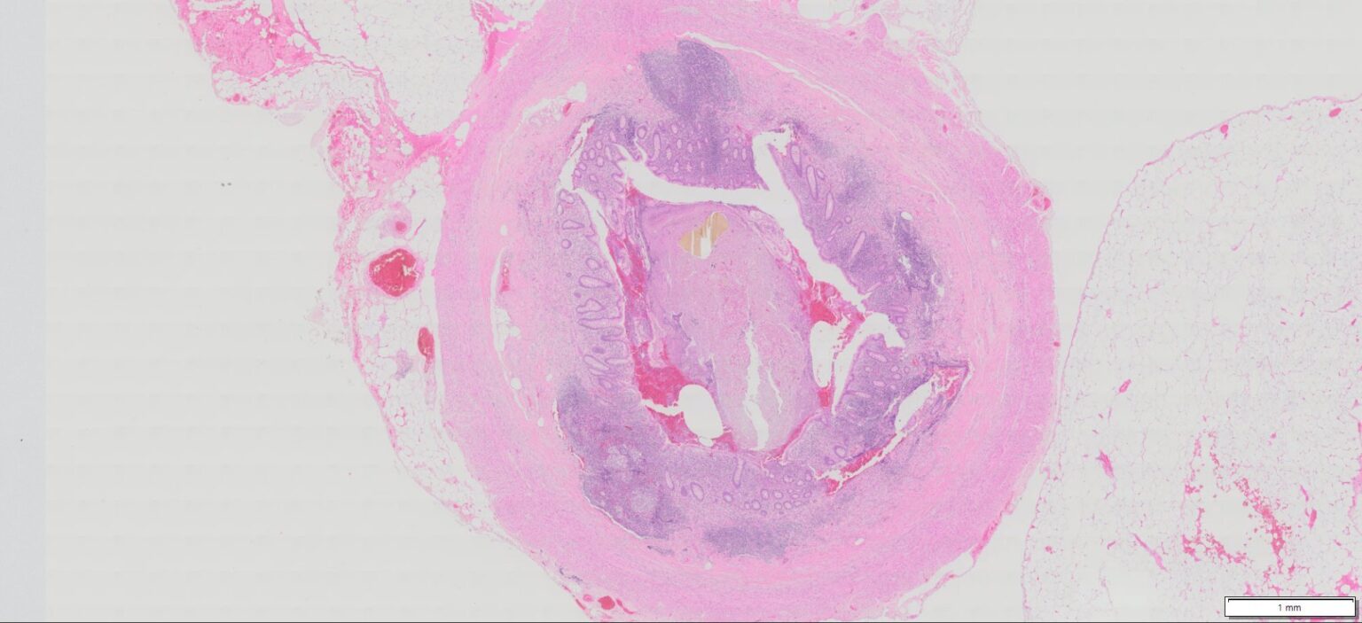 Human Appendix (Normal) FFPE Sections