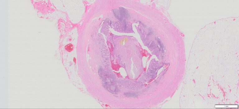Human Appendix (Normal) FFPE Sections