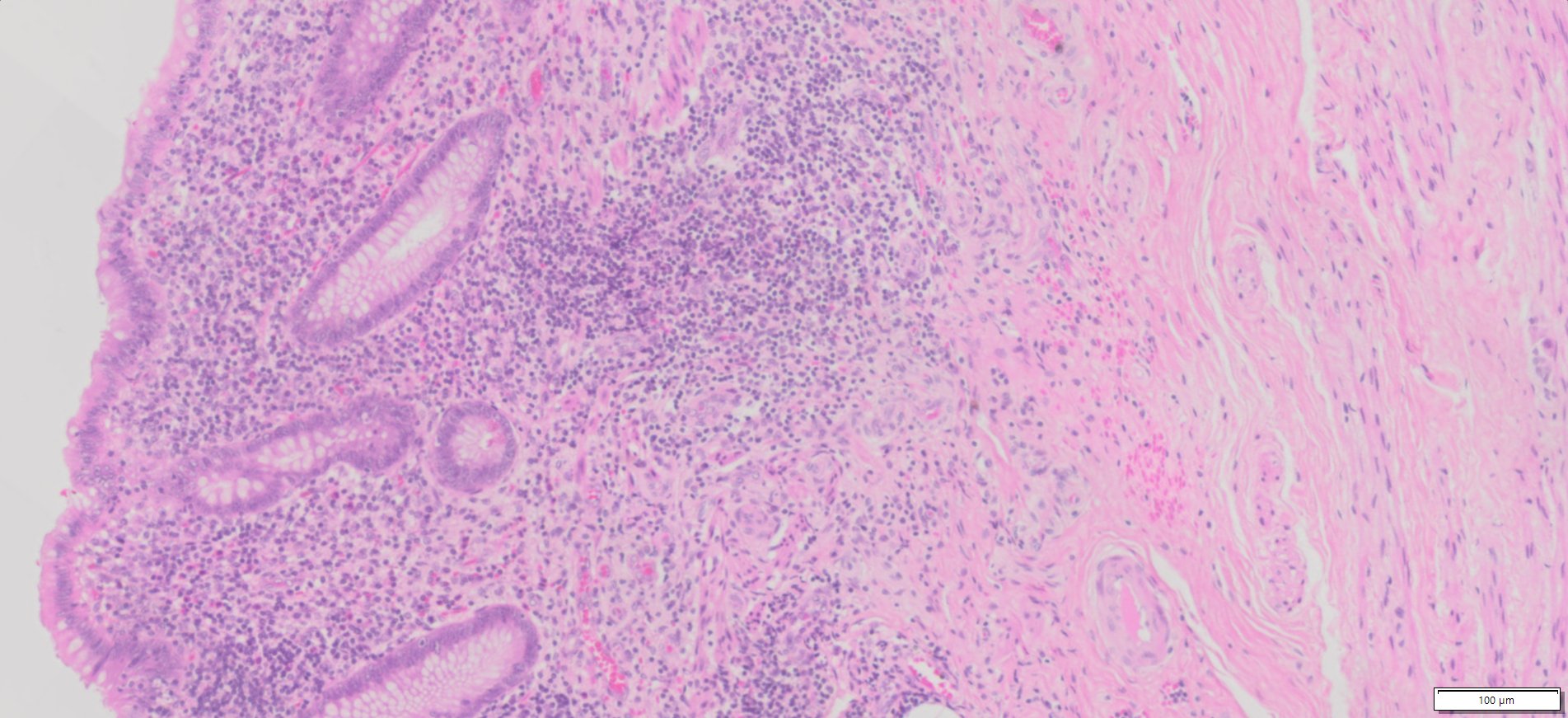 Human Appendix (Normal) FFPE Sections