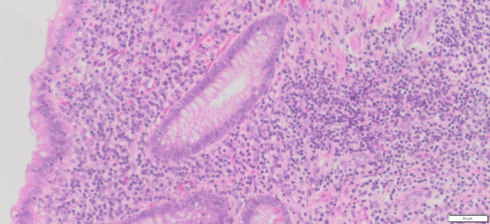 Human Appendix (Normal) FFPE Sections