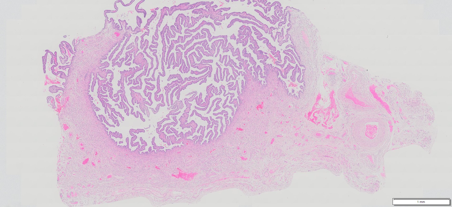 Human Fallopian Tube (Normal) FFPE Sections