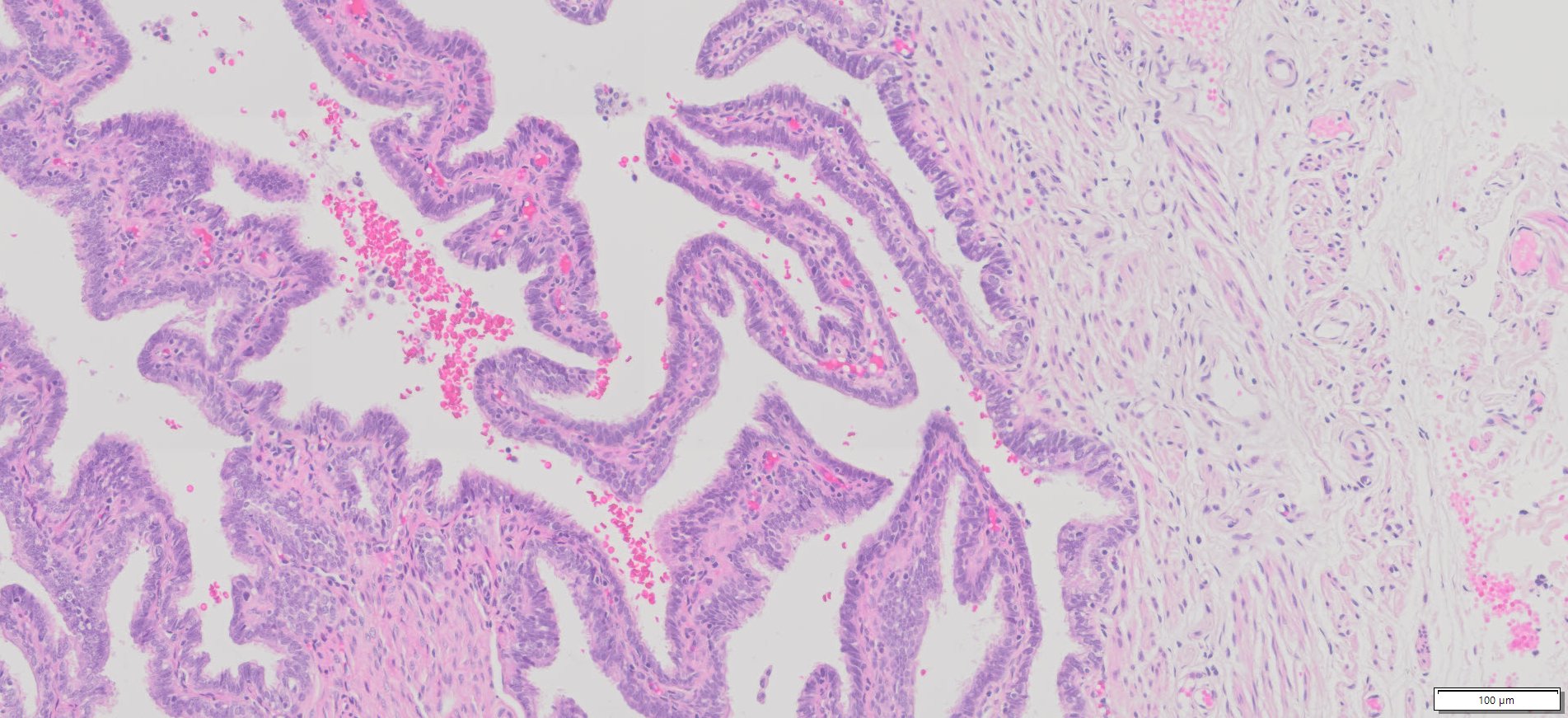Human Fallopian Tube (Normal) FFPE Sections
