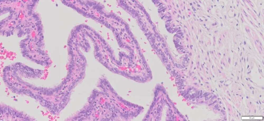 Human Fallopian Tube (Normal) FFPE Sections