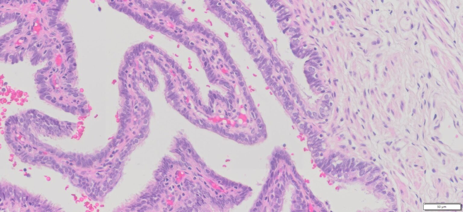 Human Fallopian Tube (Normal) FFPE Sections