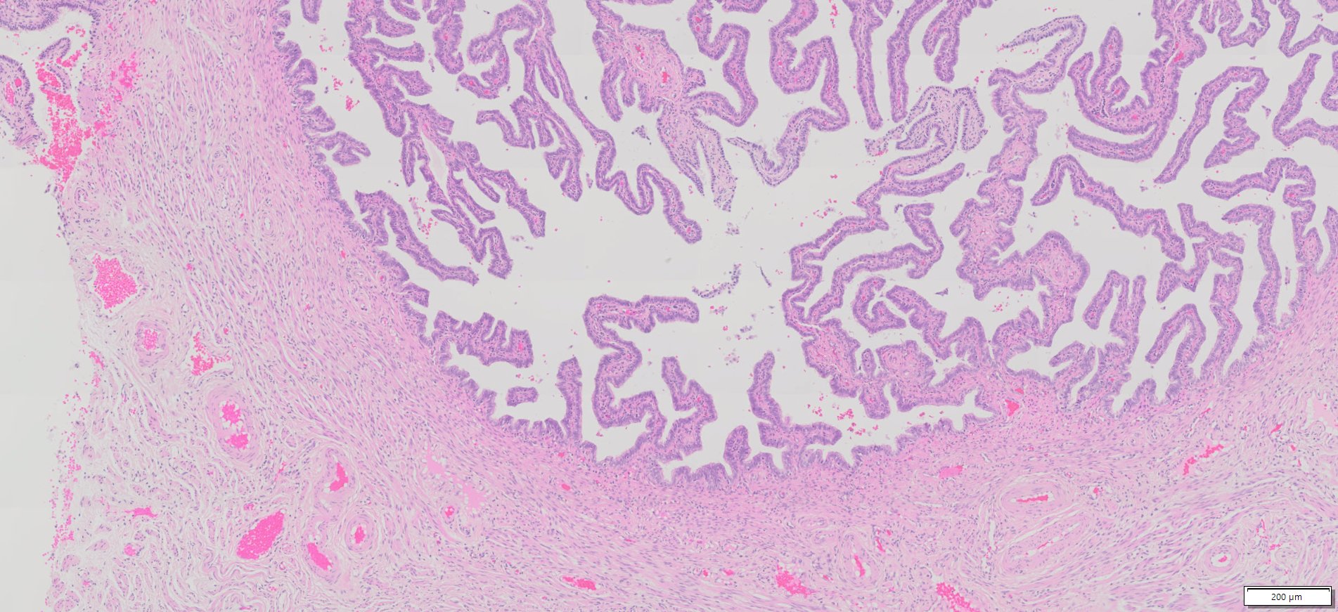Human Fallopian Tube (Normal) FFPE Sections