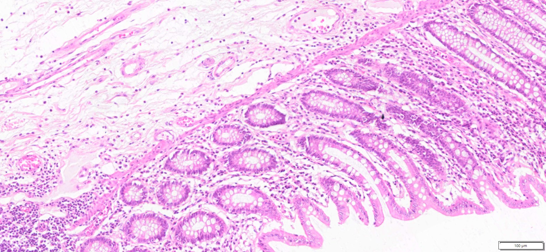 Human Colon Tissue (Normal) FFPE Sections