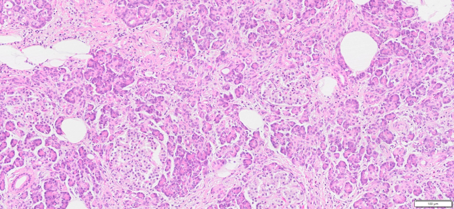 Human Pancreas Tissue (Normal) FFPE Sections
