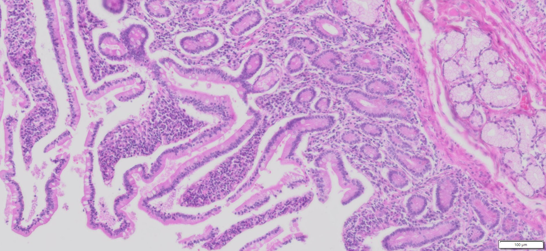 Human Pancreas Tissue (Normal, Ampulla of Vater) FFPE Sections