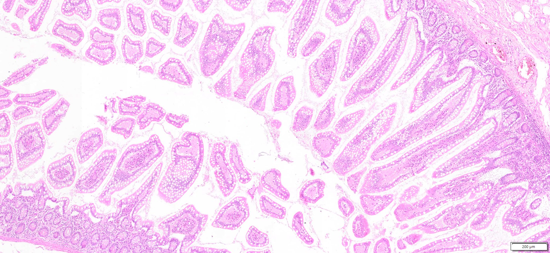 Human Small Intestine (Normal Ileum) FFPE Sections