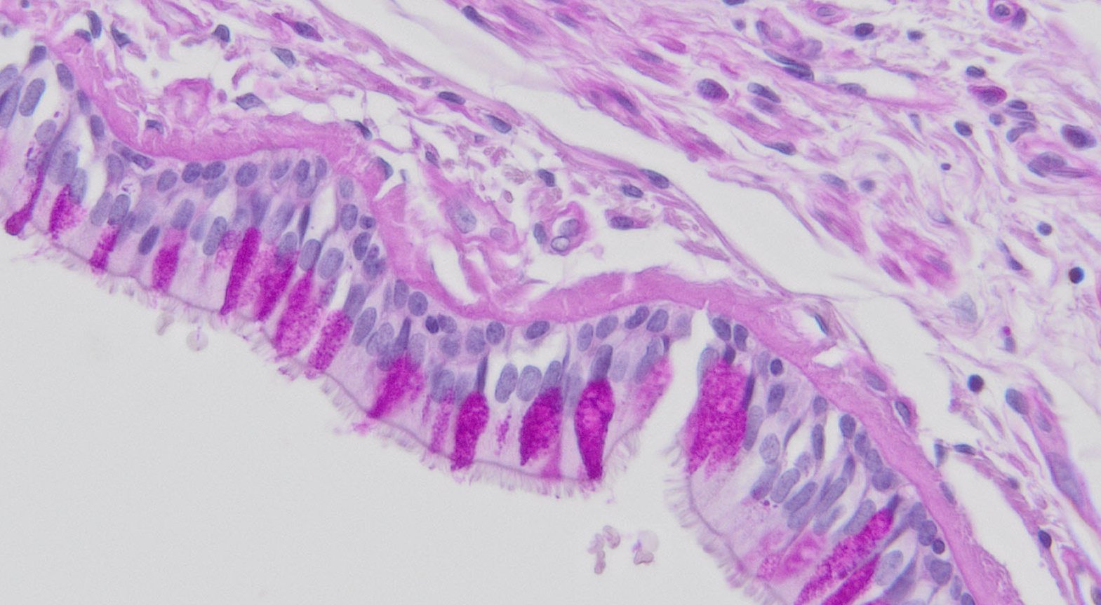 VitroView™ PAS Stain Kit