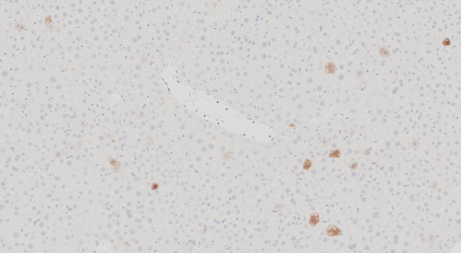 GFP Positive (Low Expression) Control FFPE Slides for in situ GFP ...
