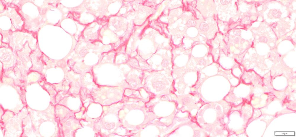 Positive Control FFPE Slides for In Situ Collagen Detection