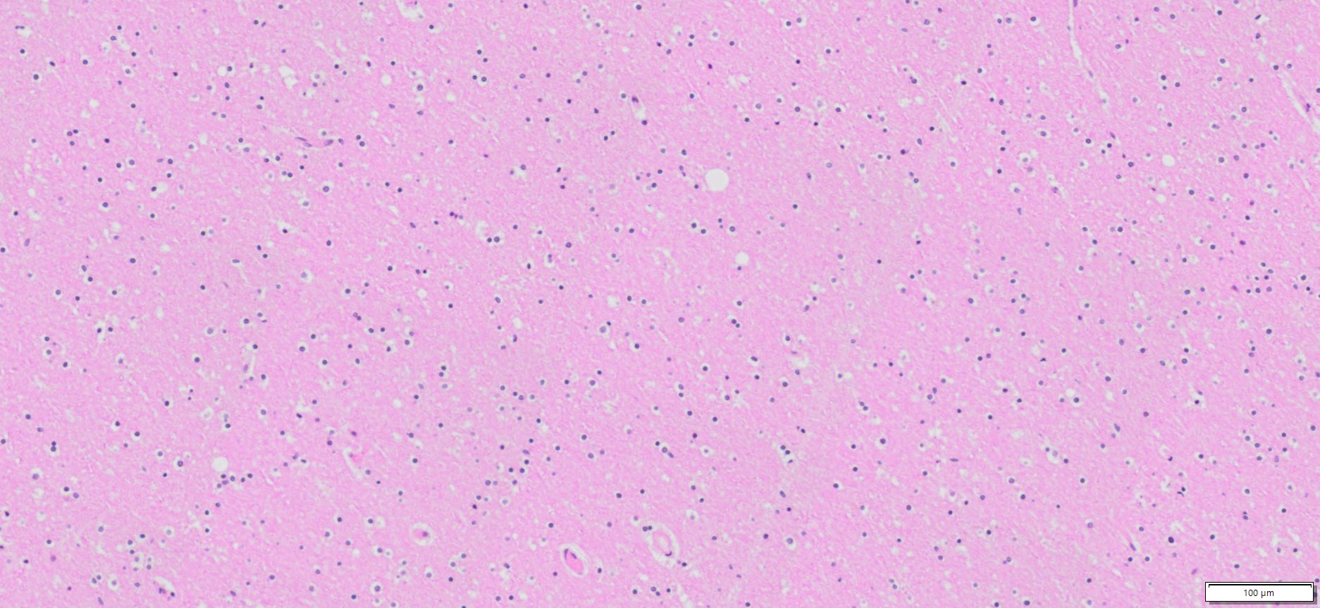Human Brain FFPE Tissue Sections (Normal Cerebral Gray Matter and White ...