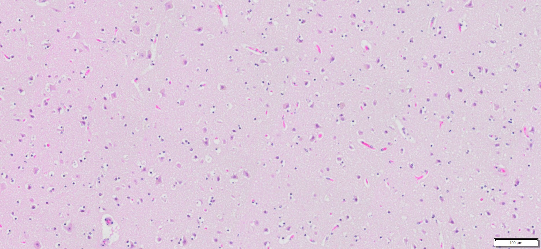 Human Brain FFPE Tissue Sections (Normal Cerebral Gray Matter and White ...
