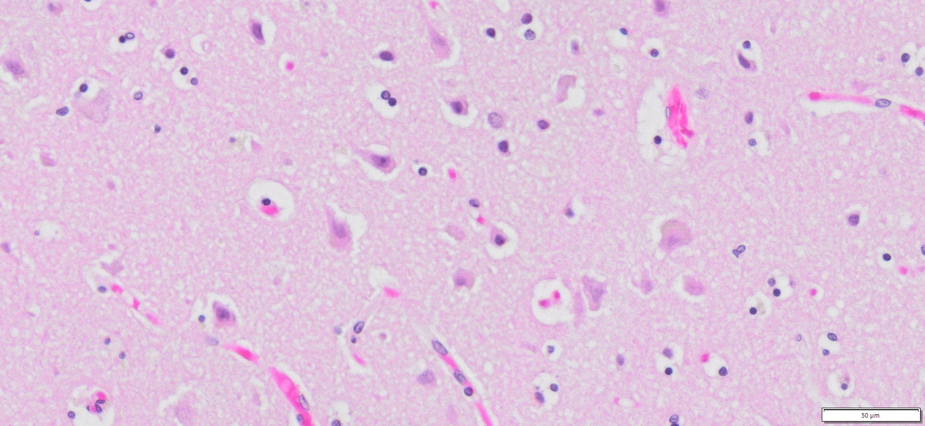 Human Brain FFPE Tissue Sections Normal Cerebral Gray Matter And White human-brain-ffpe-tissue-sections-normal-cerebral-gray-matter-and-white